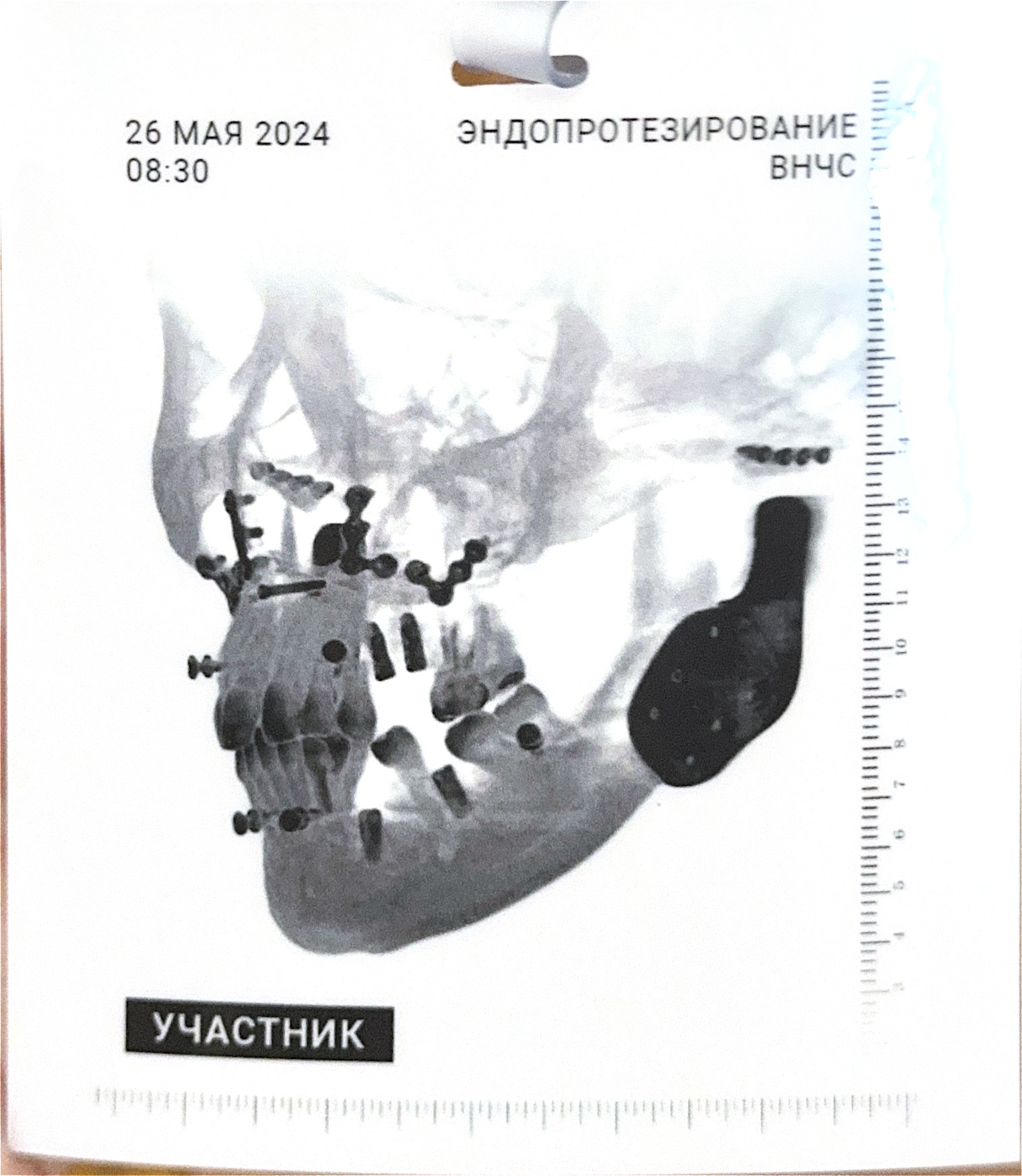 Врач-стоматолог, челюстно-лицевой хирург